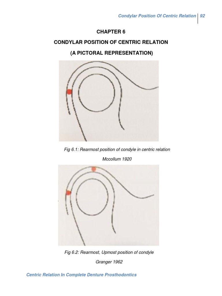 6 Condylar Position of Centric Relation | PDF