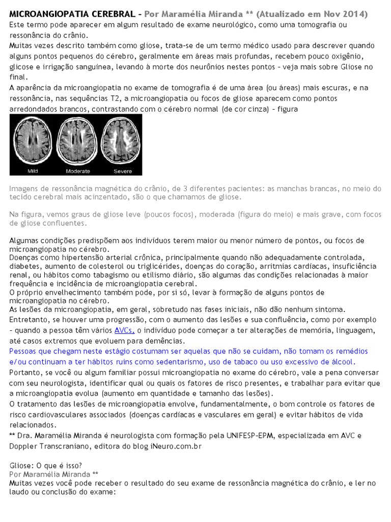 Microangiopatia Cerebral e Gliose | PDF | AVC | Telencéfalo