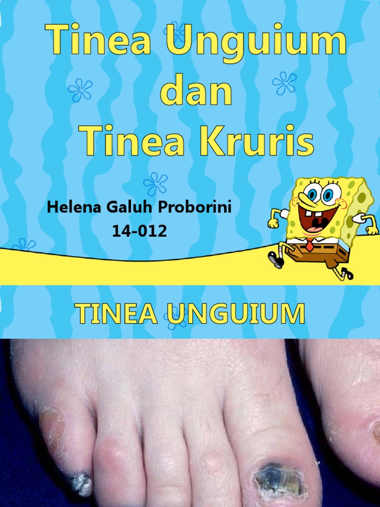 Tinea Unguium Dan Tinea Kruris | PDF