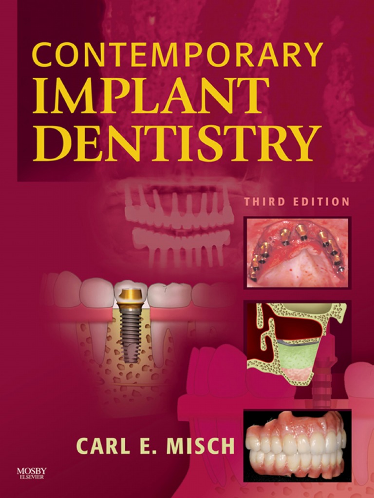 Contemporary Implant Dentistry | PDF