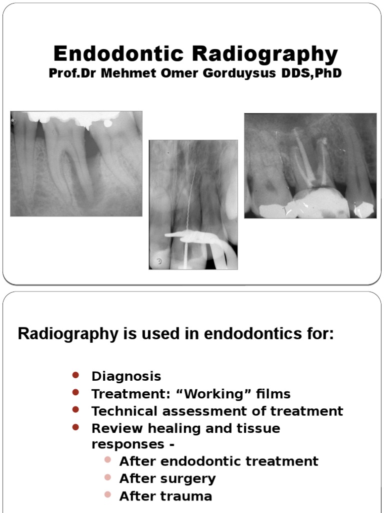 Radiography For Endodontics | PDF | Ionizing Radiation | Ct Scan