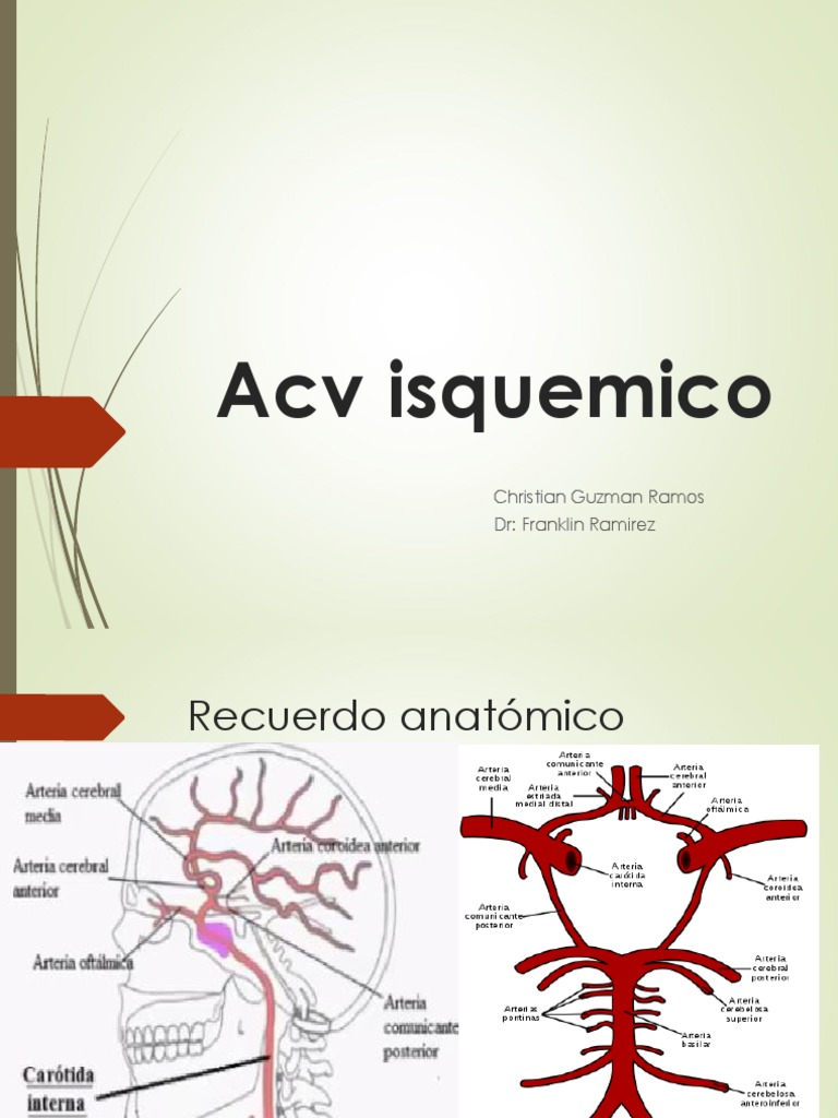 Acv Isquemico Expo | PDF | Carrera | Isquemia