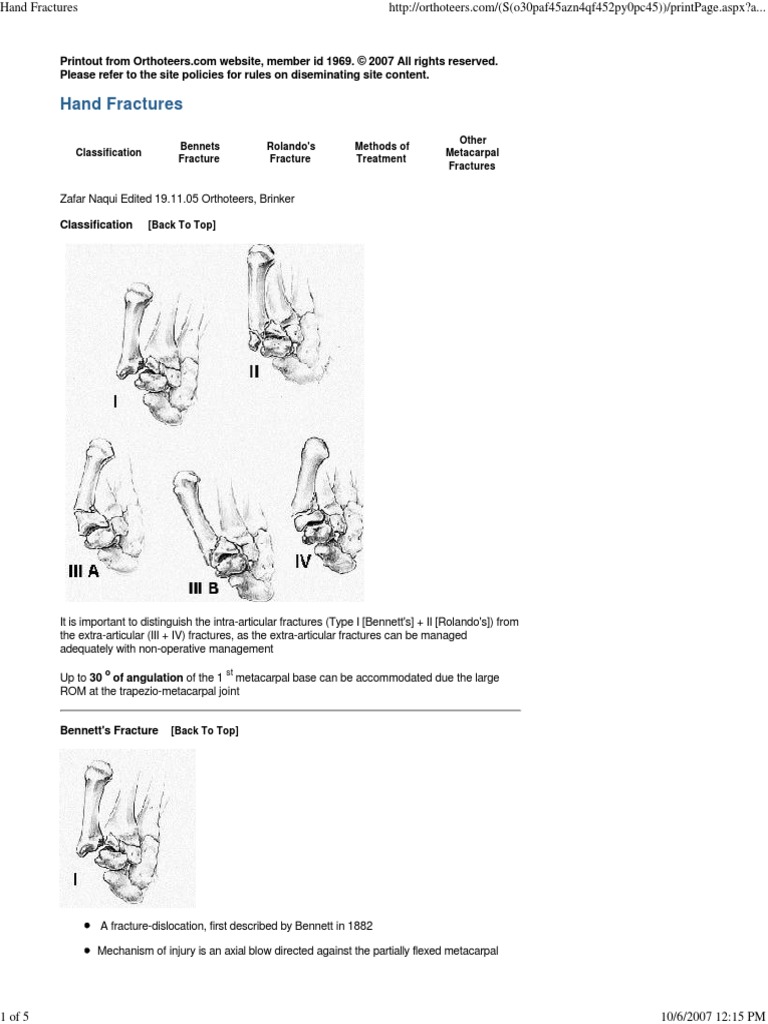 Hand Fractures PDF | PDF | Finger | Hand