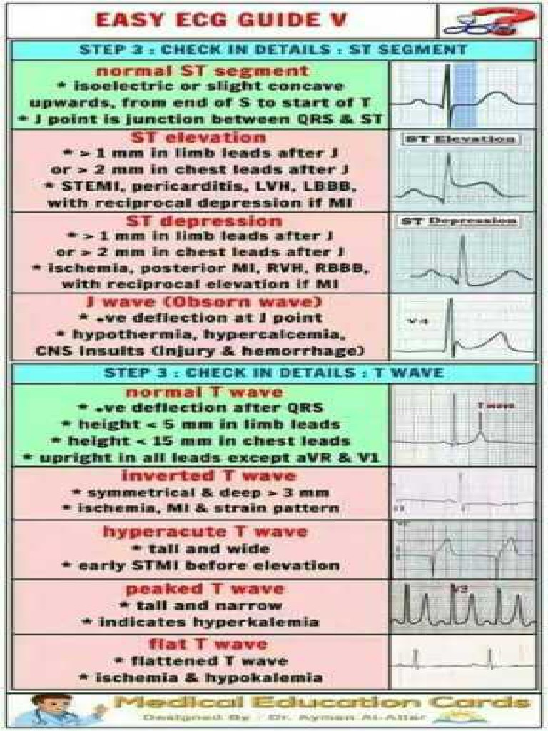 Easy Ecg Guide | PDF