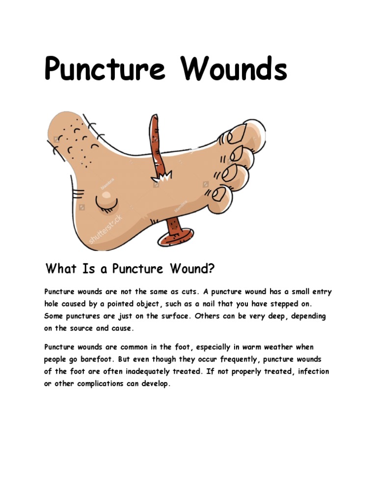 Puncture Wounds | PDF