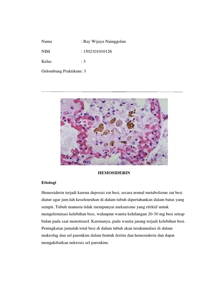 Ray Wijaya N (15-126) Hemosiderin | PDF