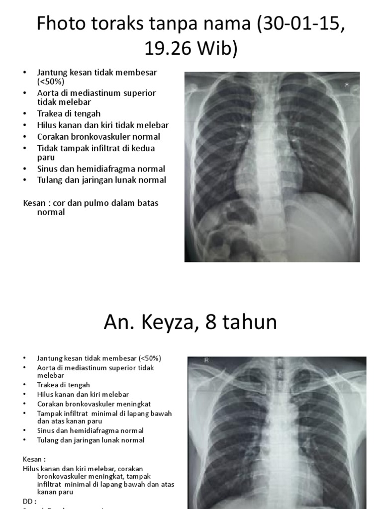 Fhoto Toraks Tugas | PDF | Gaya Hidup