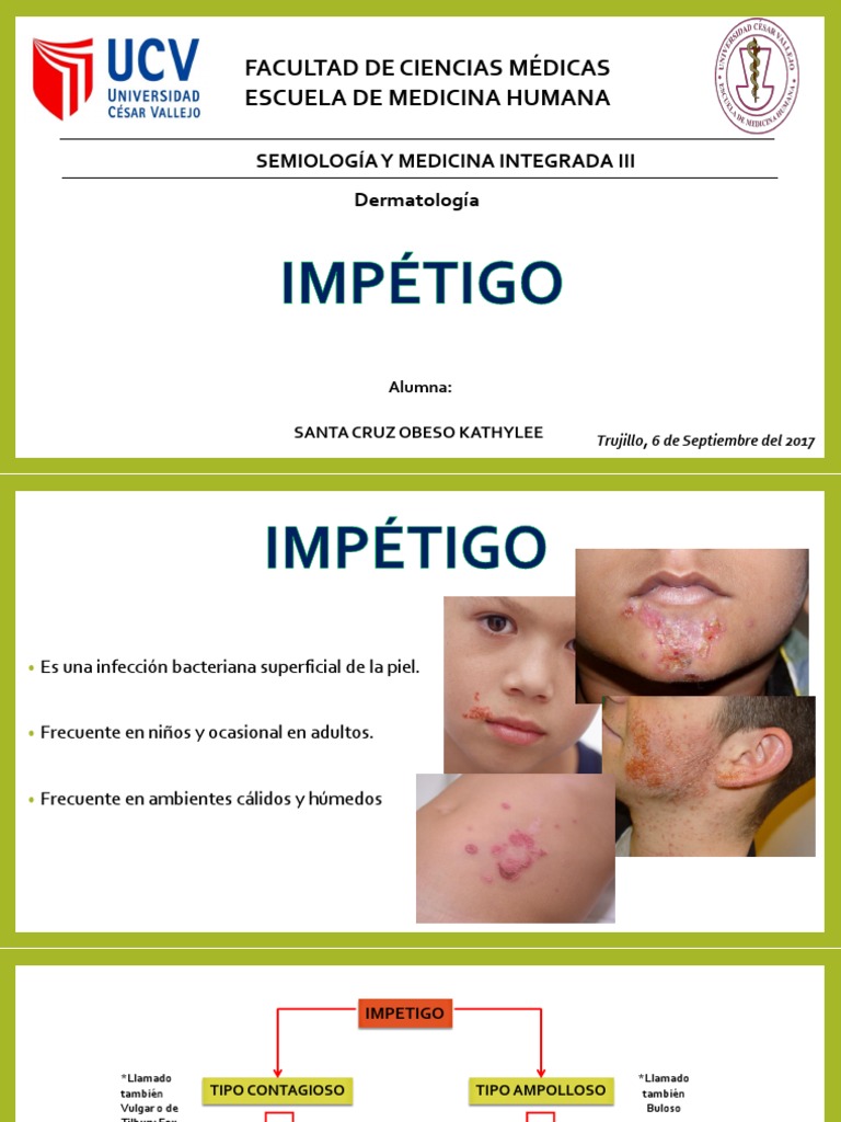 IMPÉTIGO | PDF | Inmunología | Medicina