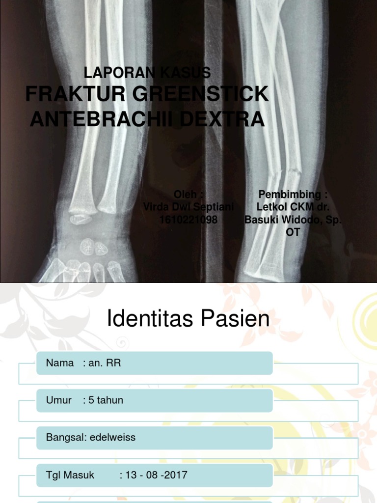 FRAKTUR GREENSTICK ANTEBRACHII DEXTRA | PDF