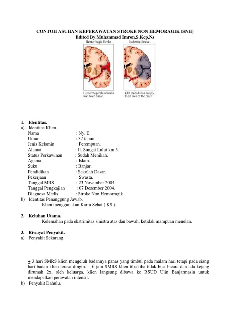 Contoh Asuhan Keperawatan Stroke Non Hemoragik | PDF | Pengembangan Diri