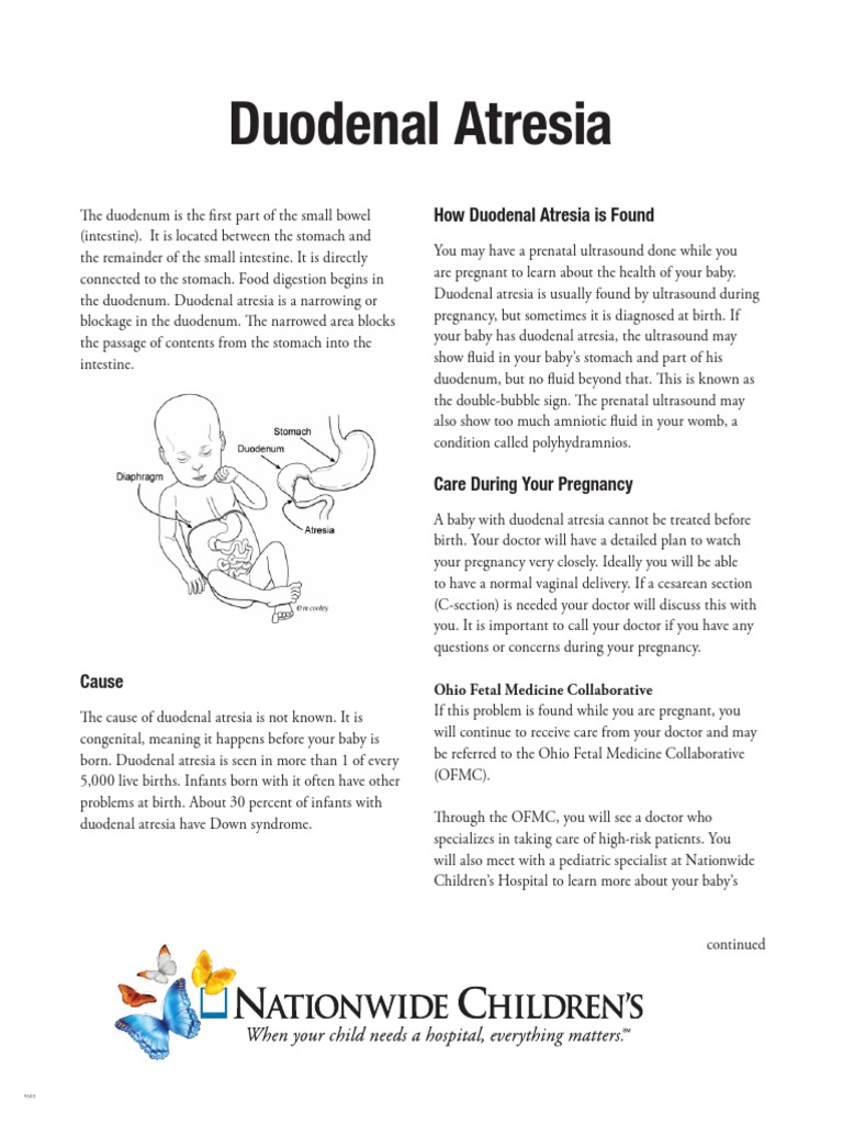 9503 Duodenal Atresia | PDF | Infants | Neonatal Intensive Care Unit