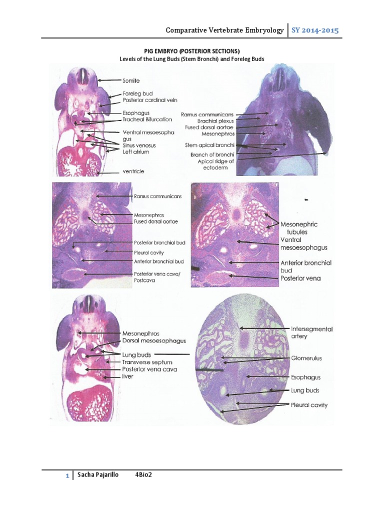 Anatomy of 10mm Pig Embryo Stages | PDF | Liver | Pancreas