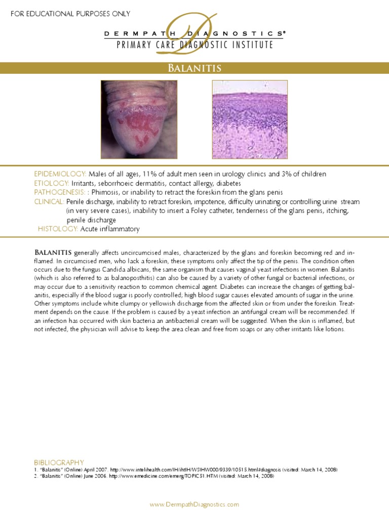 Balanitis: Primary Care Diagnostic Institute | PDF