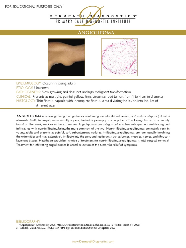 Angiolipoma: Benign Tumor Overview | PDF