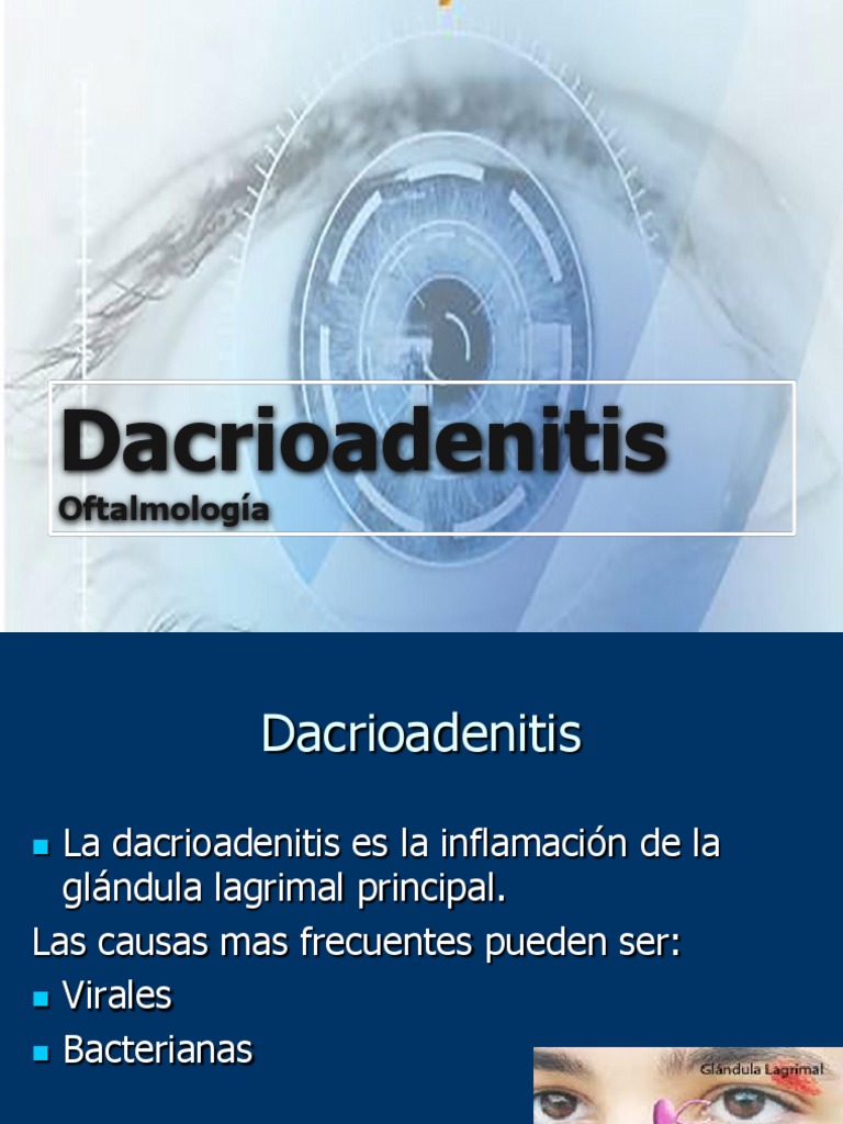 Dacrioadenitis | PDF | Inflamación | Epidemiología