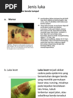 Jenis-Jenis Luka (Vulnus) dan Penanganannya | PDF