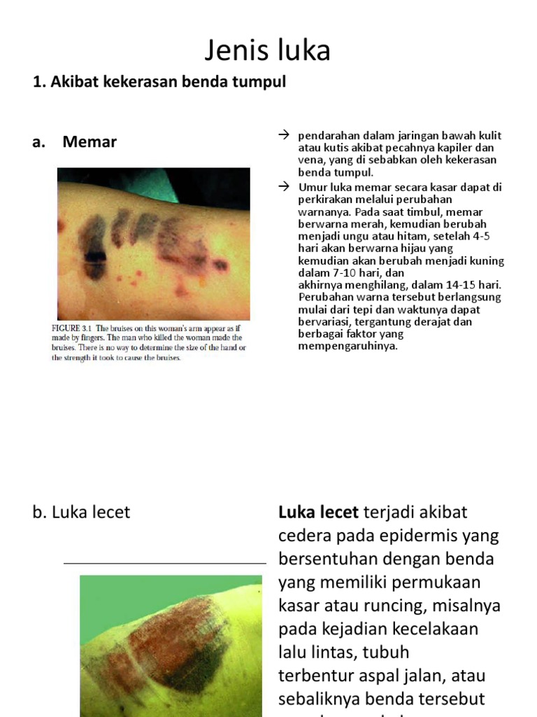 Jenis Luka | PDF