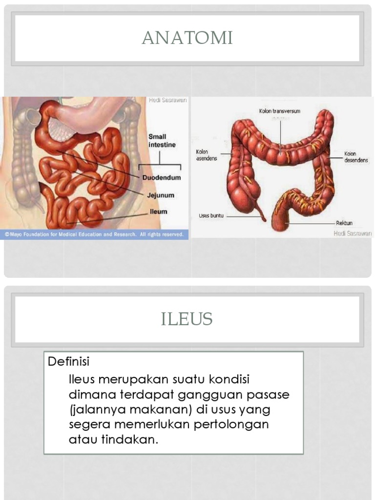 Ileus PPT Baru | PDF