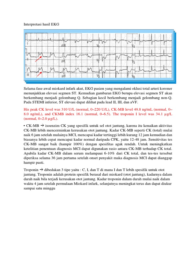 Interpretasi Hasil EKG | PDF