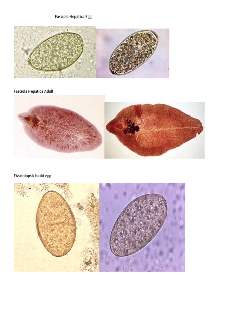 Fasciola Hepatica Egg | PDF