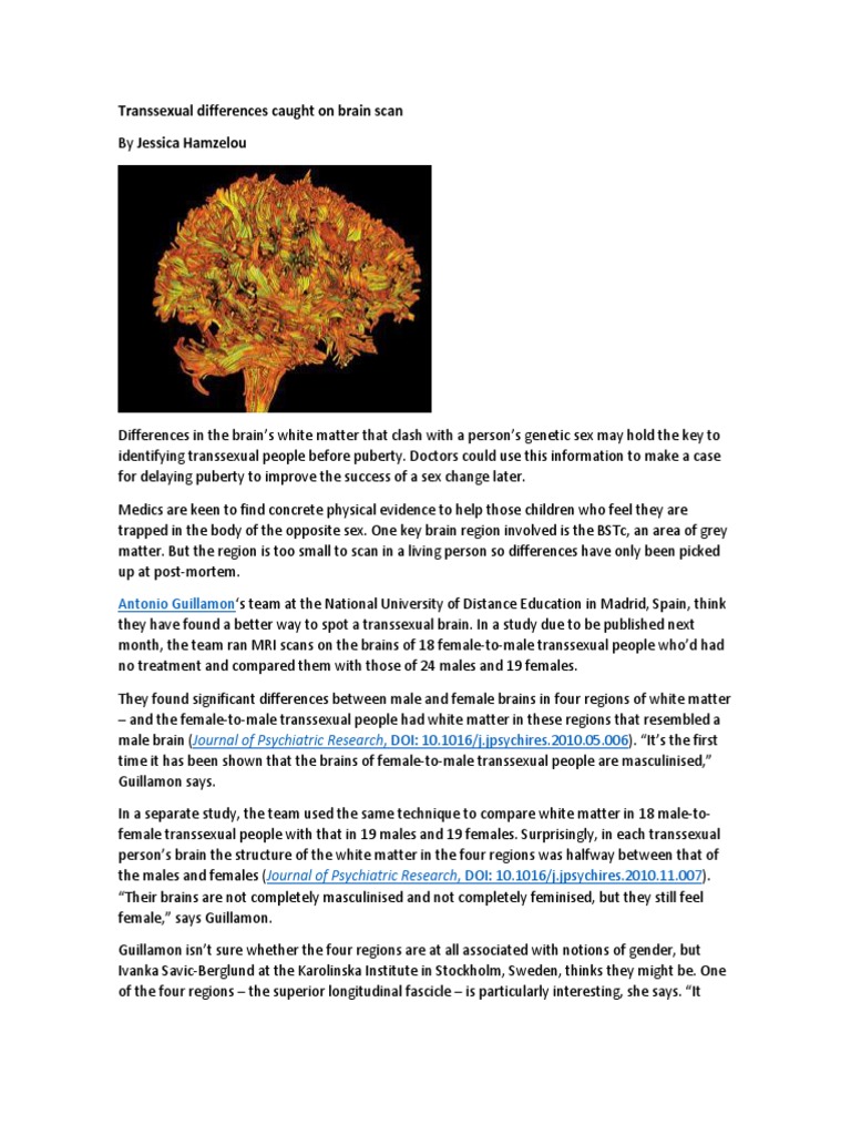 Brain Differences in Transsexuality | PDF | Transsexual | White Matter