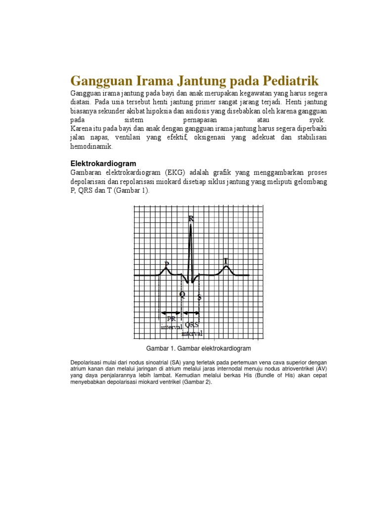 Gangguan Irama Jantung Pada Pediatrik | PDF
