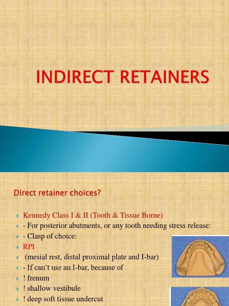 Indirect Retainers | PDF | Anatomical Terms Of Location | Dentures