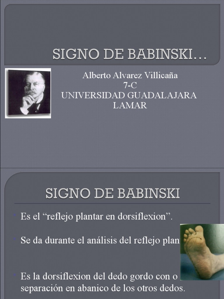 Signo de Babinski | PDF