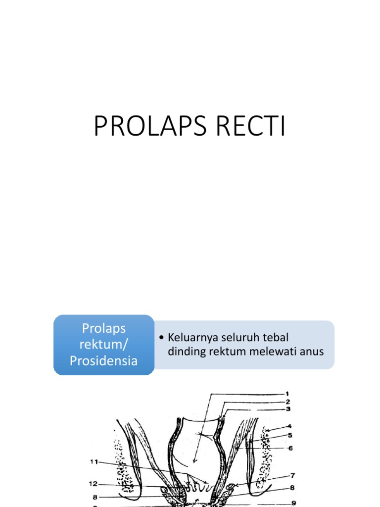 Prolaps Rectal | PDF
