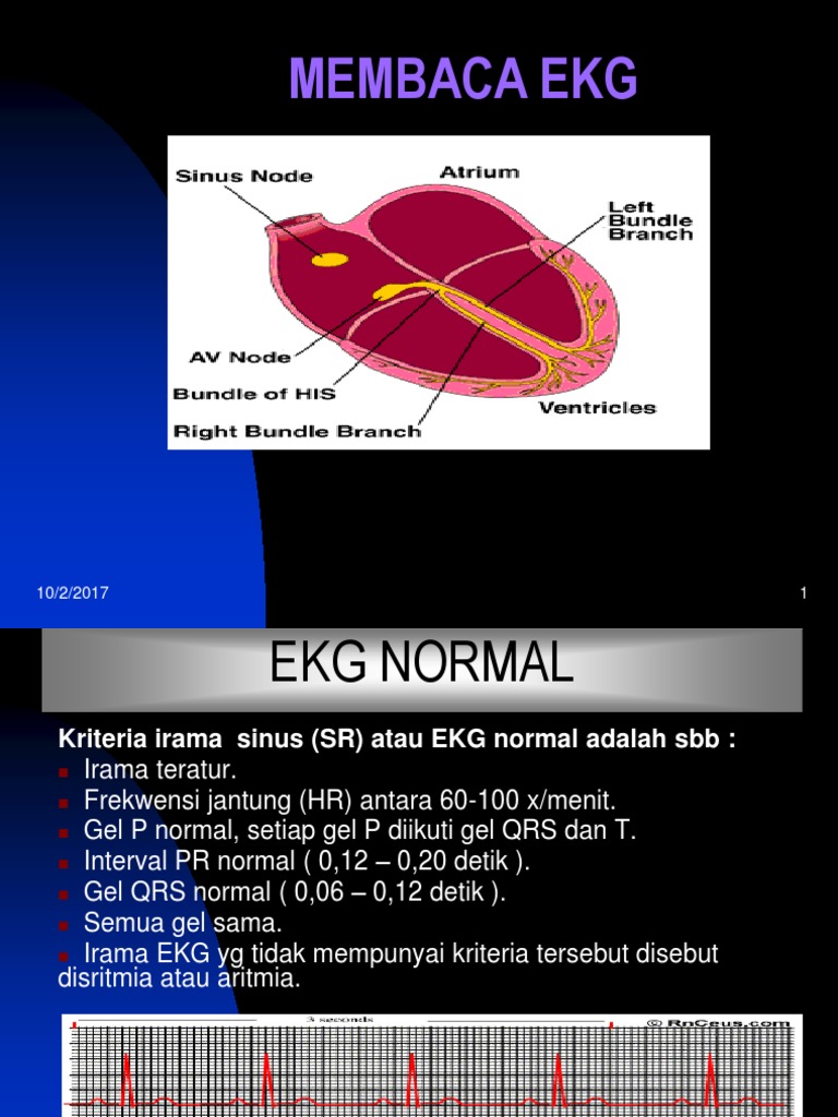 Membaca Ekg | PDF