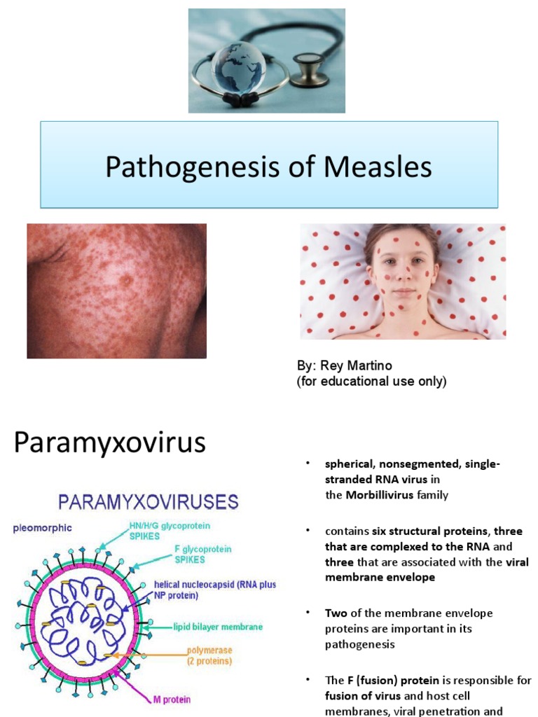 Pathogenesis of Measles Pathogenesis of Measles: By: Rey Martino (For ...