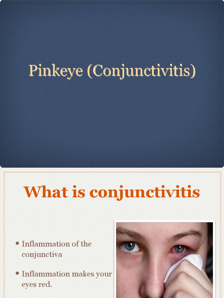 Conjunctivitis | PDF | Self-Improvement | Wellness