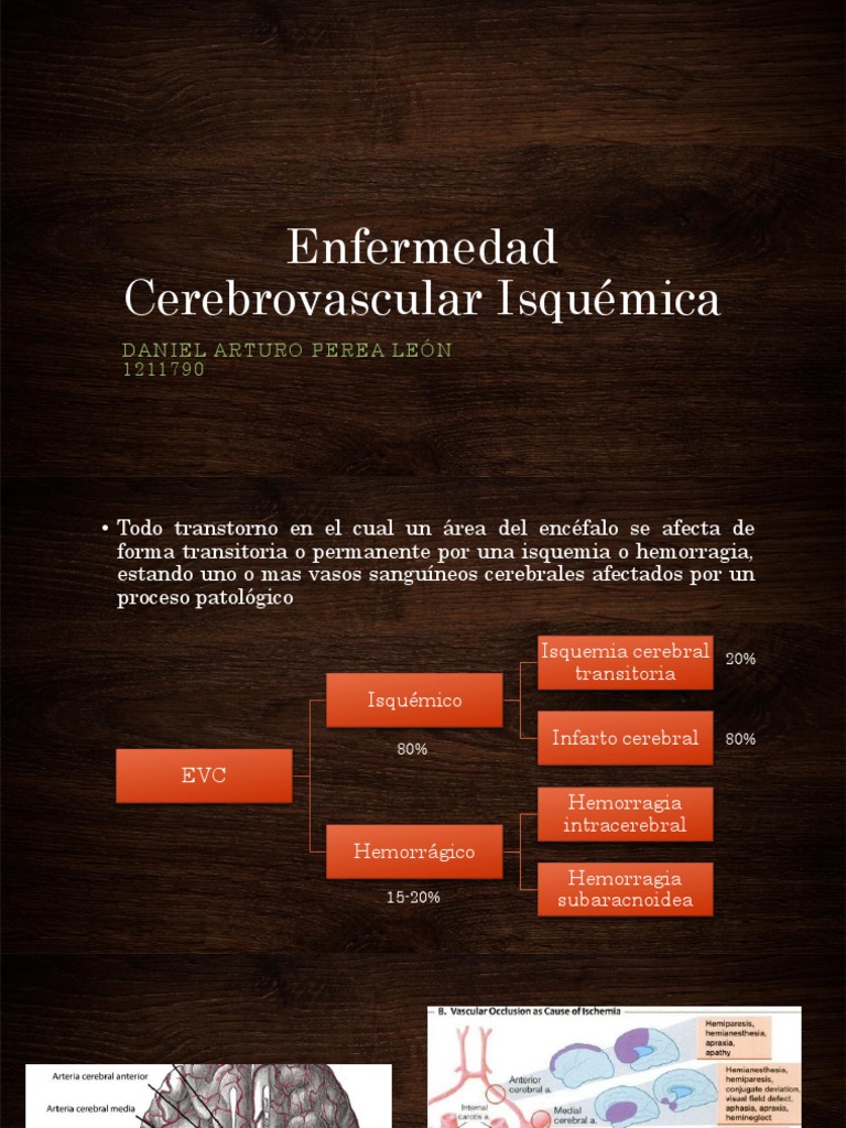 Enfermedad Cerebrovascular de Tipo Isquémico | PDF | Isquemia | Carrera