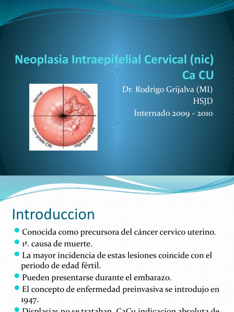 Neoplasia Intraepitelial Cervical (Nic)