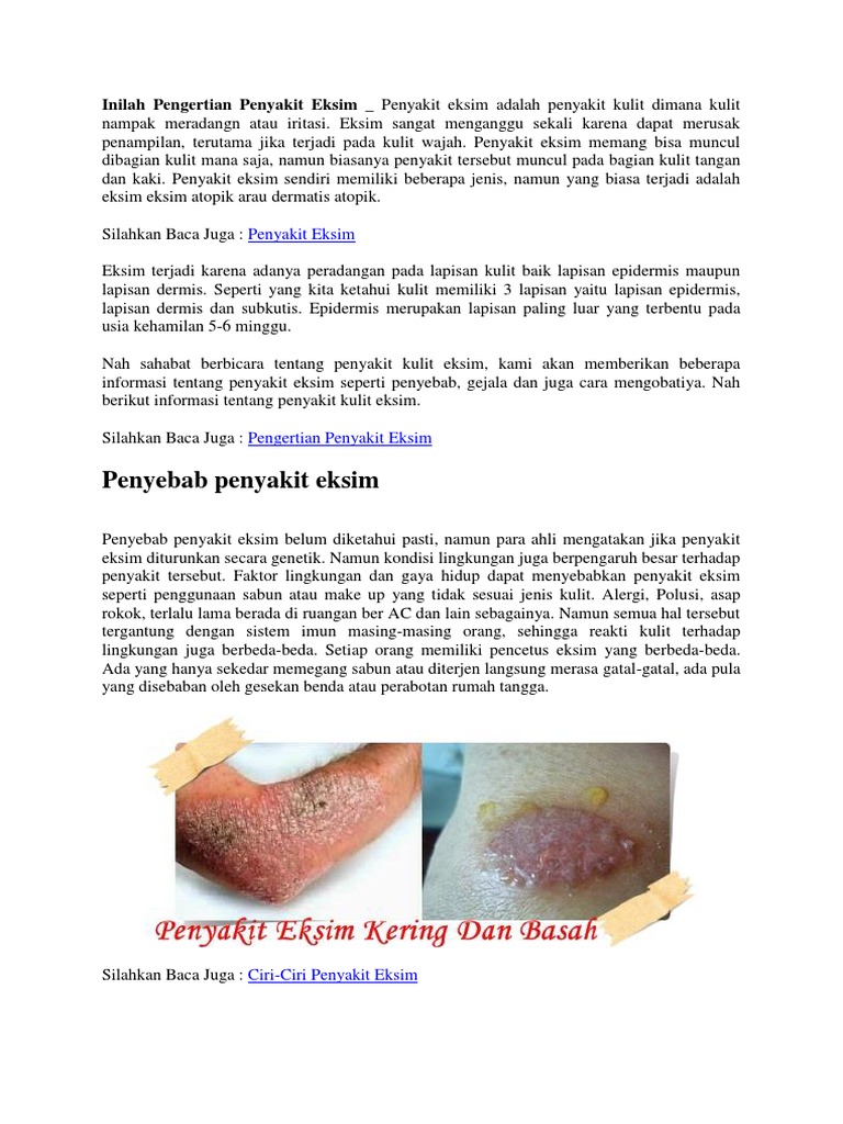 Pengertian dan Gejala Penyakit Eksim | PDF