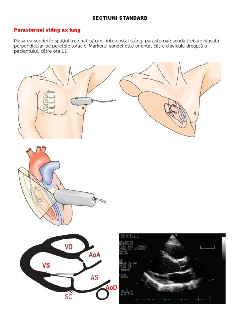 EcoCardiografia Sectiuni Standard PDF | PDF