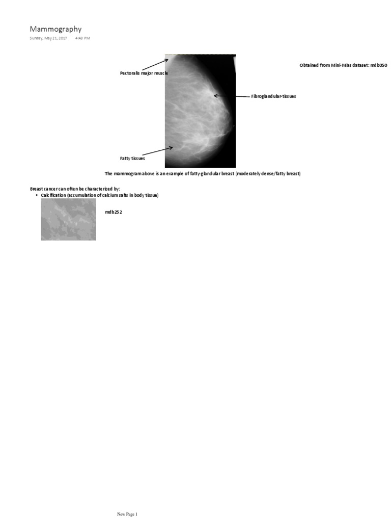 Mammography | PDF
