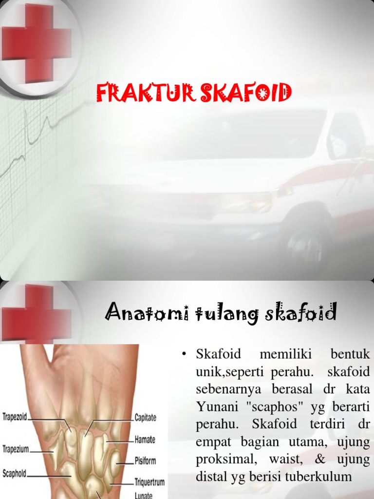 Fraktur Skafoid | PDF