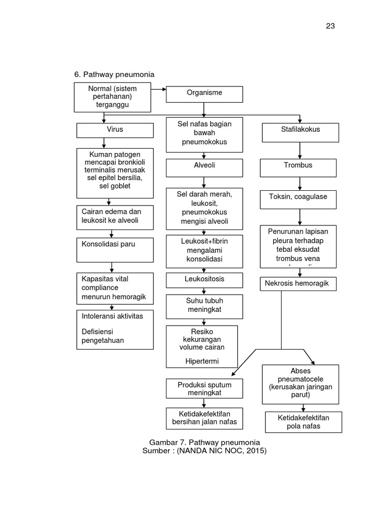 Pathways of Pneumonia: A Diagram Detailing the Progression and Complications of Bacterial, Viral ...