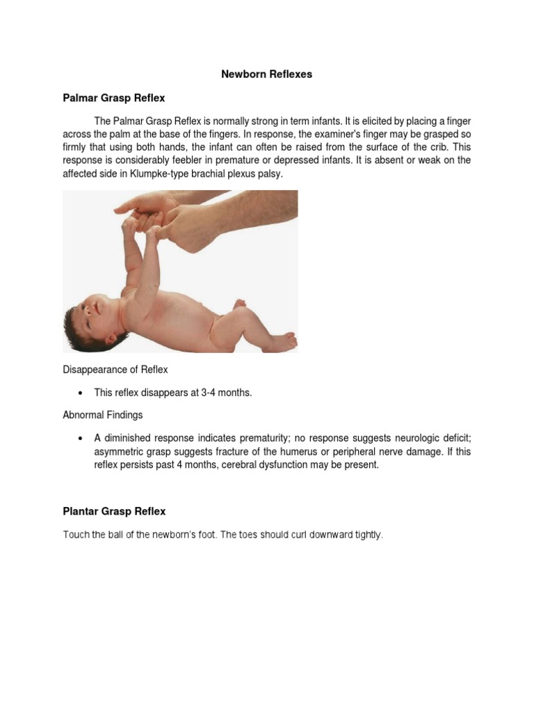 Newborn Reflexes | PDF | Anatomical Terms Of Motion | Infants