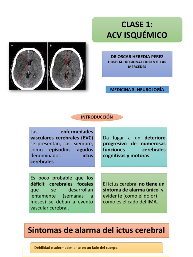 ACV ISQUÉMICO Exposición | PDF | Carrera | Isquemia