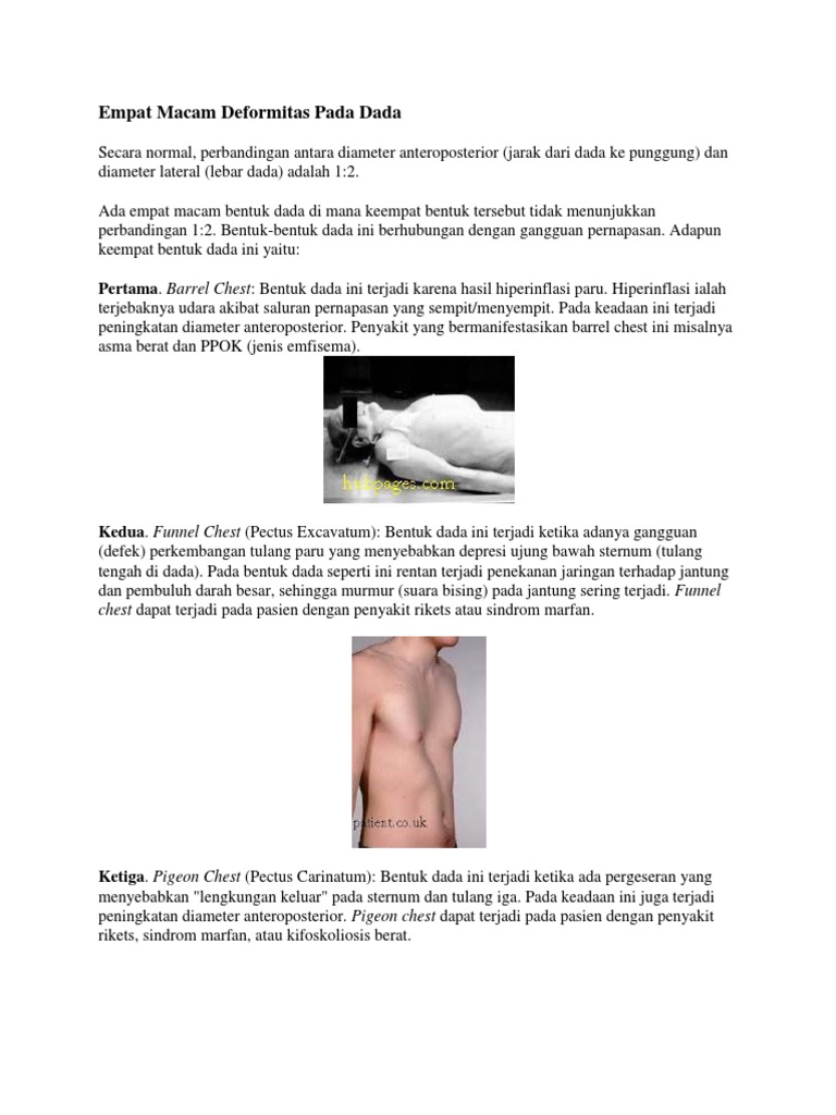 Empat Macam Deformitas Pada Dada | PDF