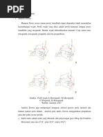 Prosedur Restorasi Inlay dan Onlay Gigi | PDF