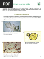 Mini Atlas de Urinálise | PDF