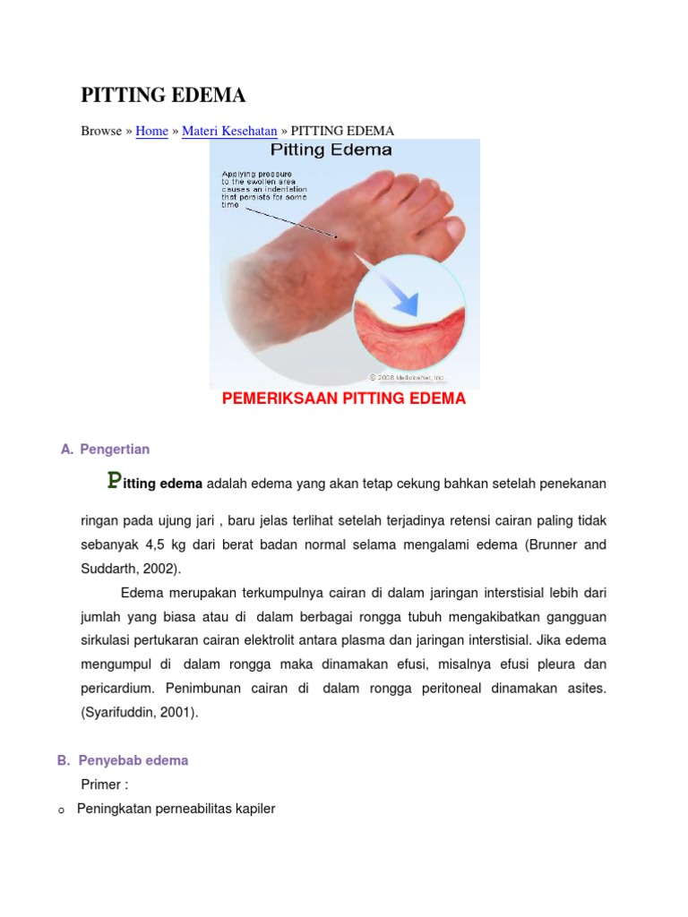 Pitting Edema | PDF