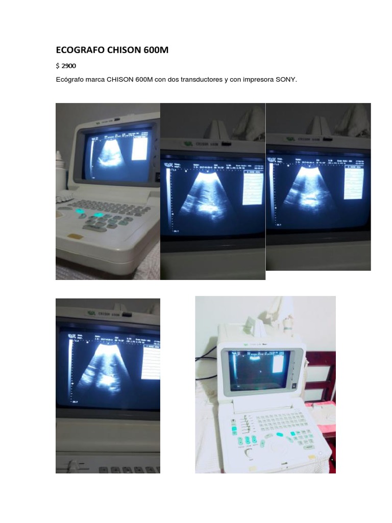 Ecografo Chison 600M | PDF