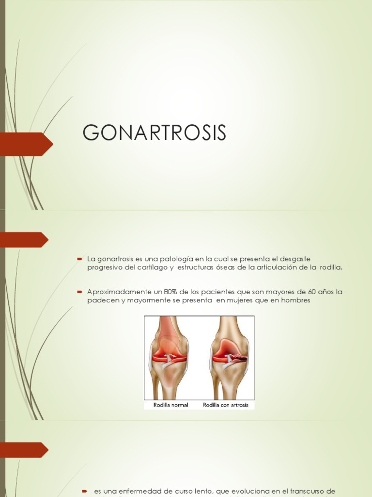 Presentación Gonartrosis | Osteoartritis | Enfermedades y trastornos