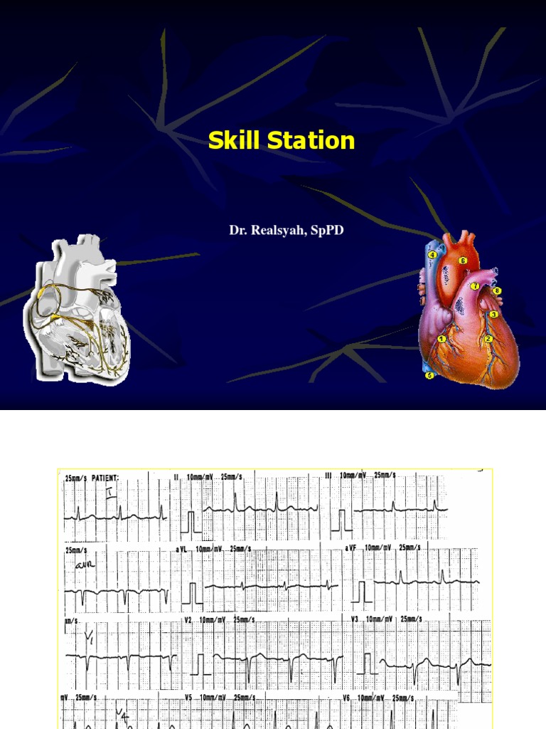 EKG 4 Skill Satation | PDF