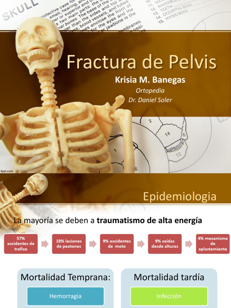 Fracturas de Pelvis: Clasificación, Mecanismos de Lesión, Signos ...