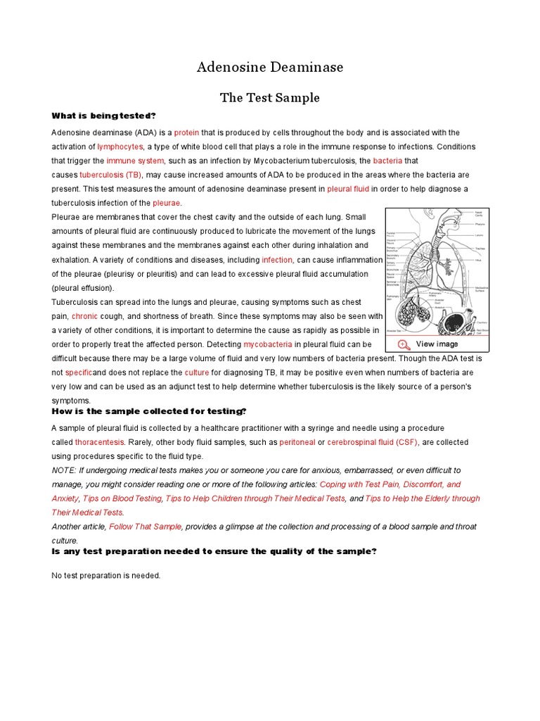 Adenosine Deaminase: The Test Sample | PDF | Tuberculosis | Medical ...